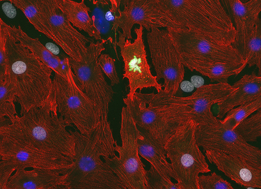 Bergmann Group | Universitätsmedizin Göttingen